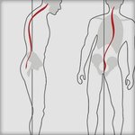 Scoliosis - An Abnormal Curvature of the Spine - Apex Chiropractic